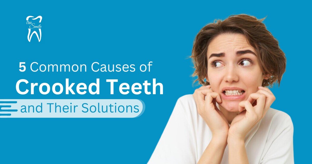 5 Common Causes of Crooked Teeth and Their Solutions
